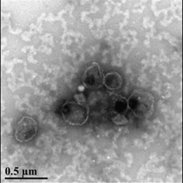 ExoQuick-TC® ULTRA for Tissue Culture Media | System Biosciences