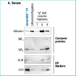 SmartSEC™ HT EV Isolation System for Serum & Plasma | System Biosciences