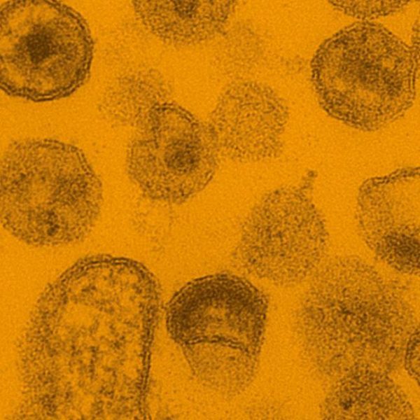 LentiSuite & LentiStarter High-Titer Lentivirus Kits | System Bio