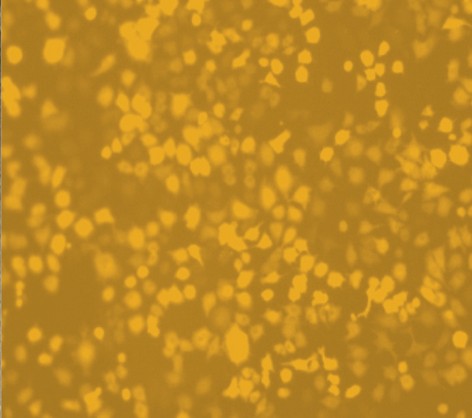 Discover Gram-negative bacterial OMVs fast with ExoELISA-Ultra BamA Kit ...